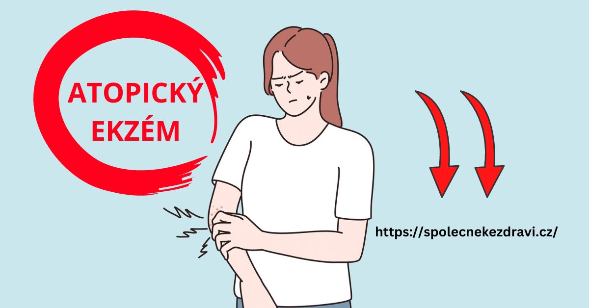 Jak na atopický ekzém?
